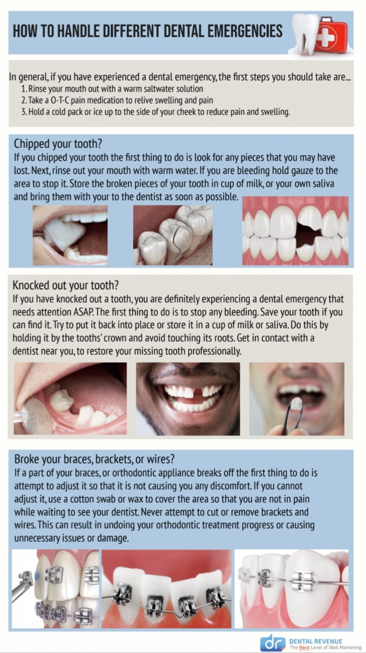 Emergency Dentist in Indianapolis IN | Dr. Ben Ahlbrecht